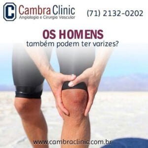 Os homens também podem ter varizes? - Cambra Clinic